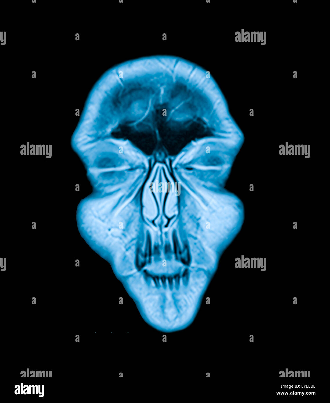 mri head magnetic resonance image of the head scan Stock Photo - Alamy