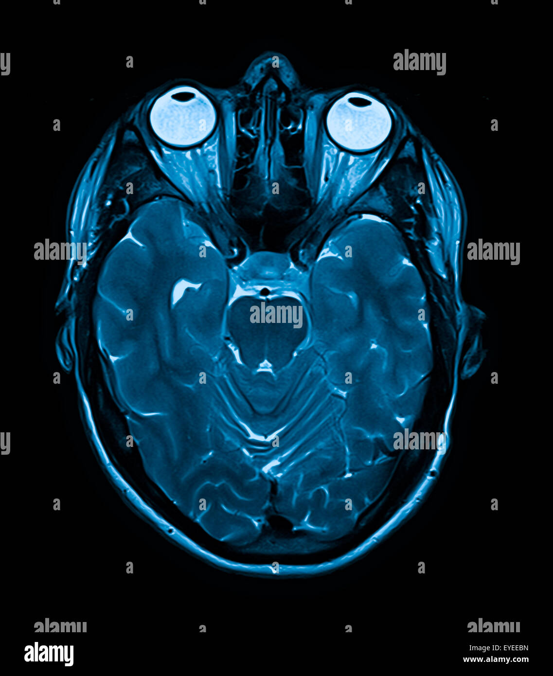 mri head magnetic resonance image of the head scan Stock Photo - Alamy