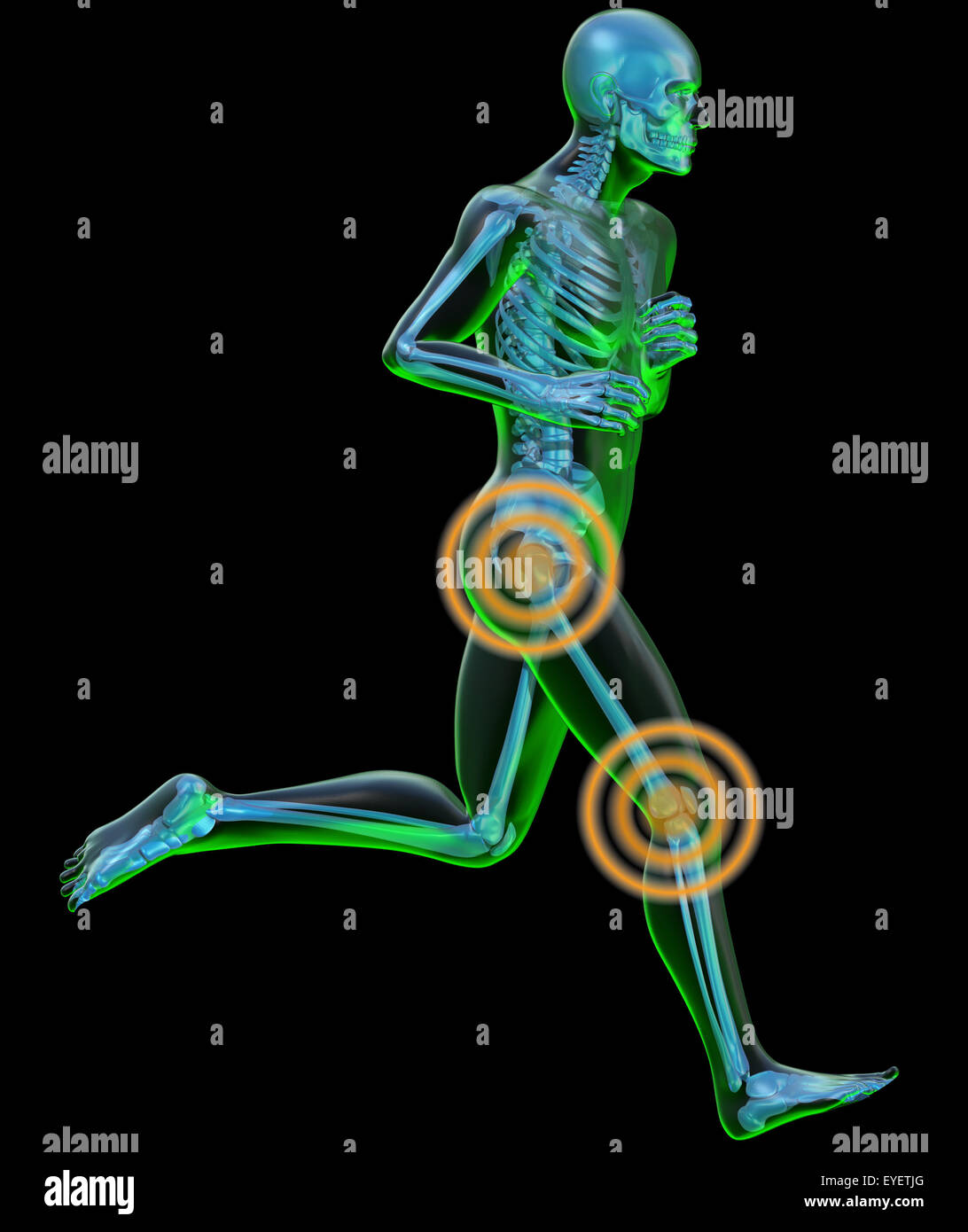 Radiograph of a human body in the act of running with hip pain and knee ...