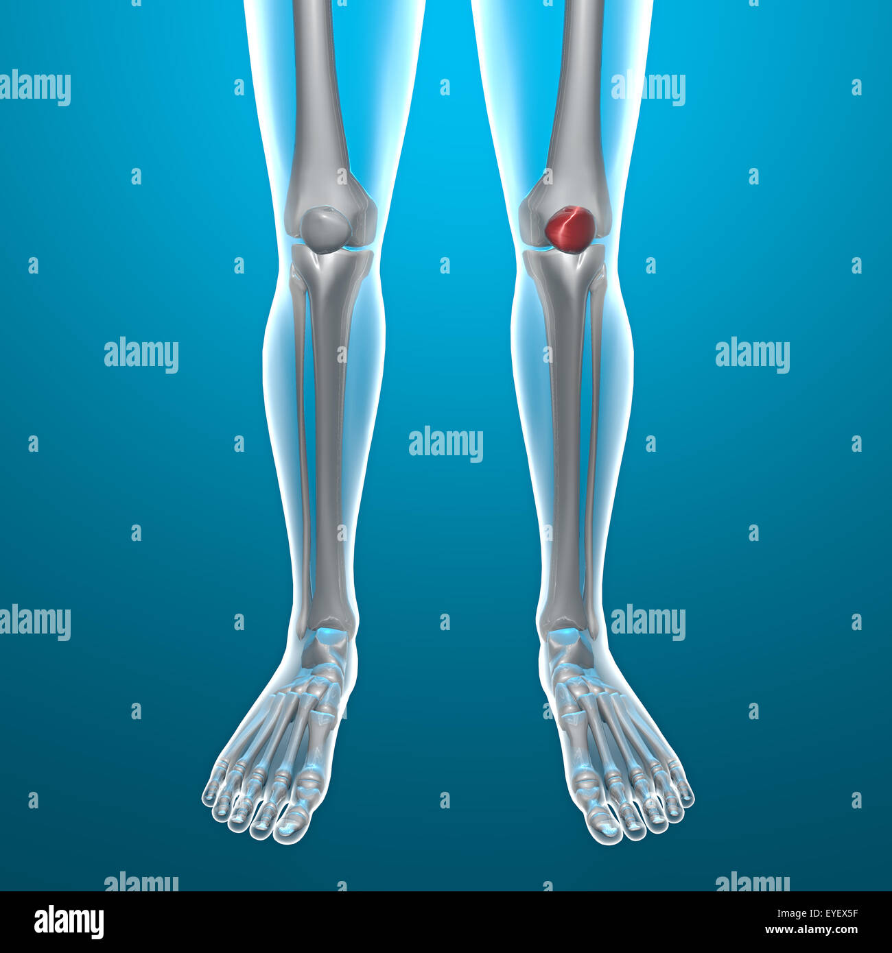 X-ray of human legs Stock Photo - Alamy
