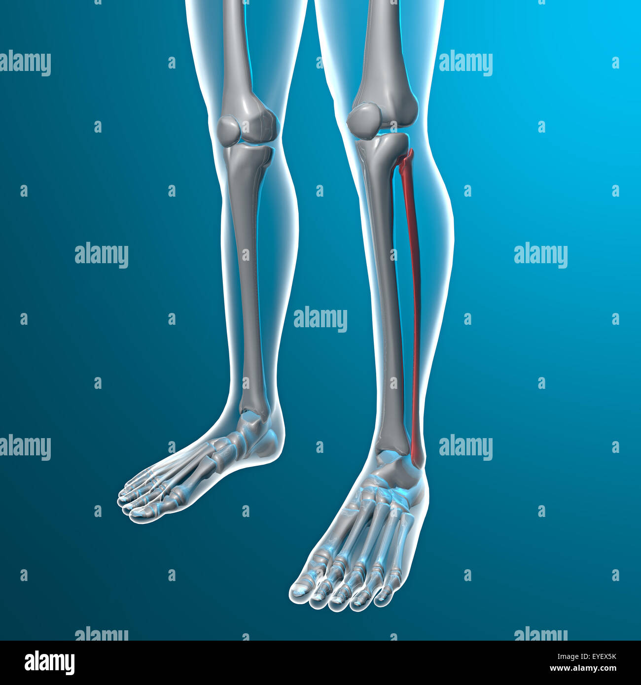 X-ray of human legs Stock Photo - Alamy
