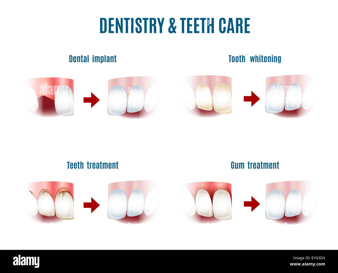 Realistic dental health concept Stock Vector Images - Alamy