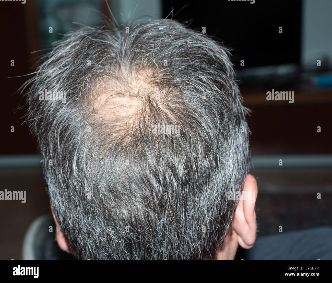 Bald man back of head hi-res stock photography and images - Alamy