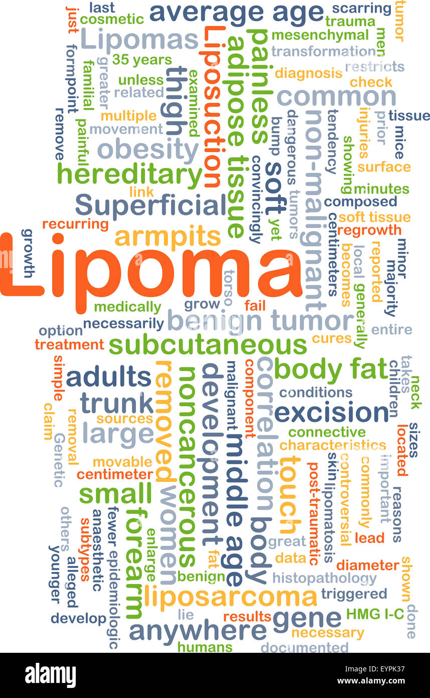 Lipoma hi-res stock photography and images - Alamy