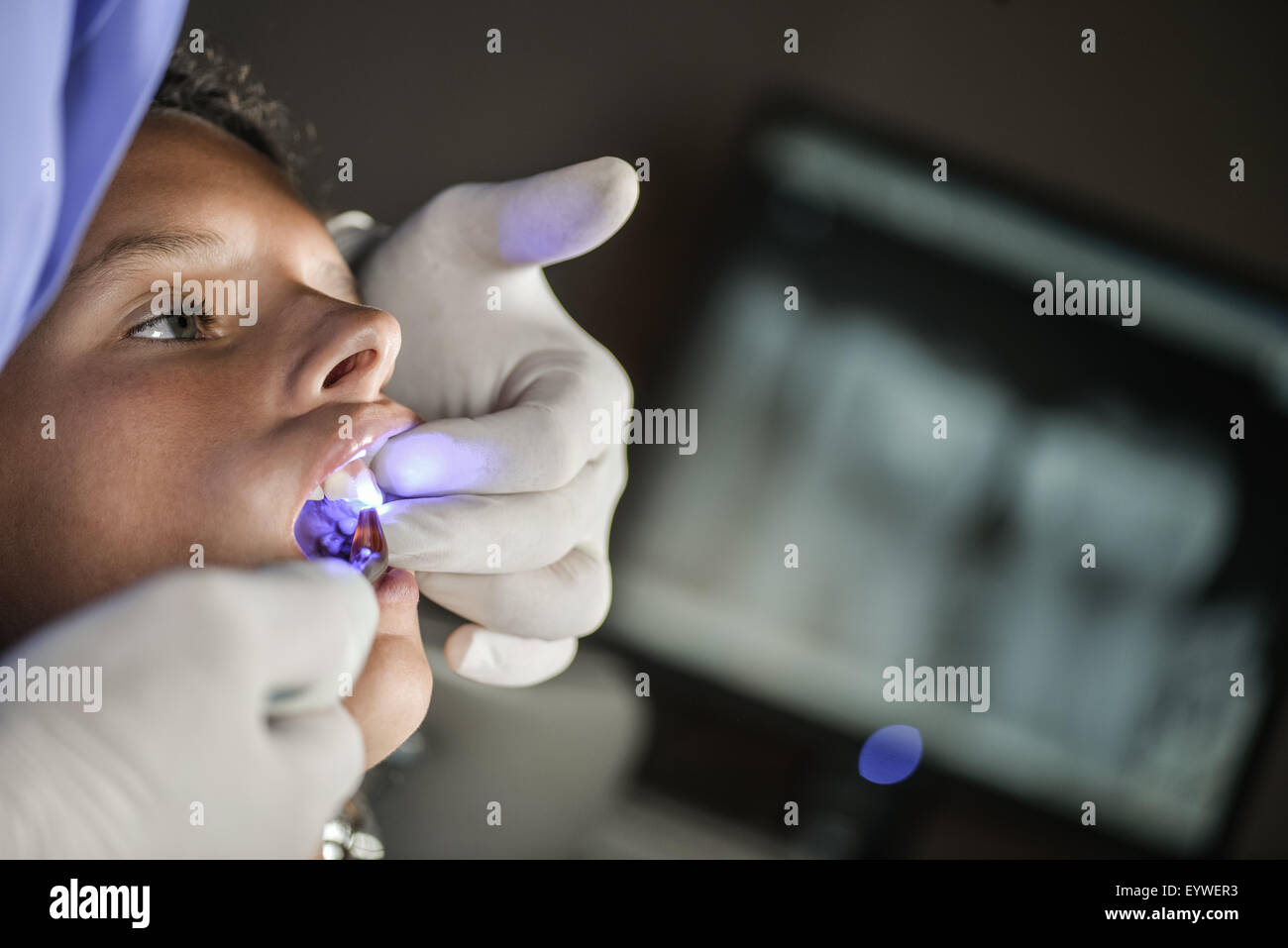 Woman undergoing dental procedure Stock Photo - Alamy