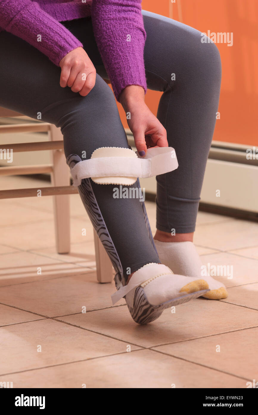 Young woman with right sided Cerebral Palsy putting a brace on her foot ...