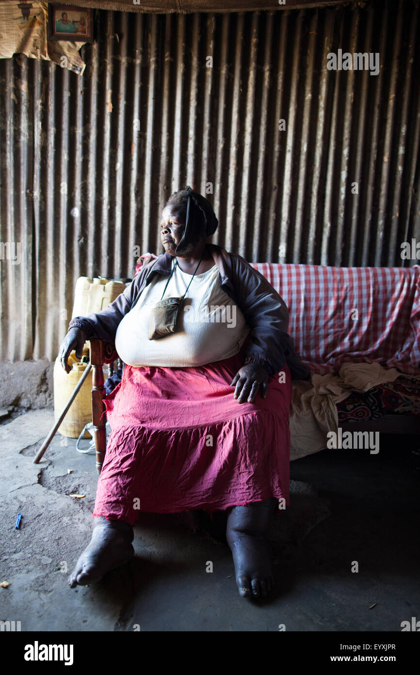 Morbidly obese woman hi-res stock photography and images - Alamy