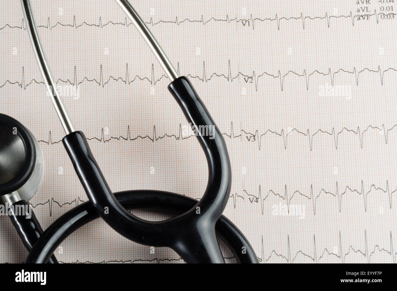 Electrocardiogram stress test hi-res stock photography and images - Alamy