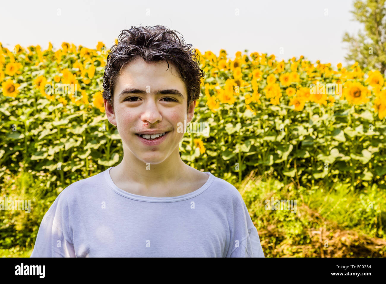 Natural and healthy living - Caucasian boy with acne and pimples ...