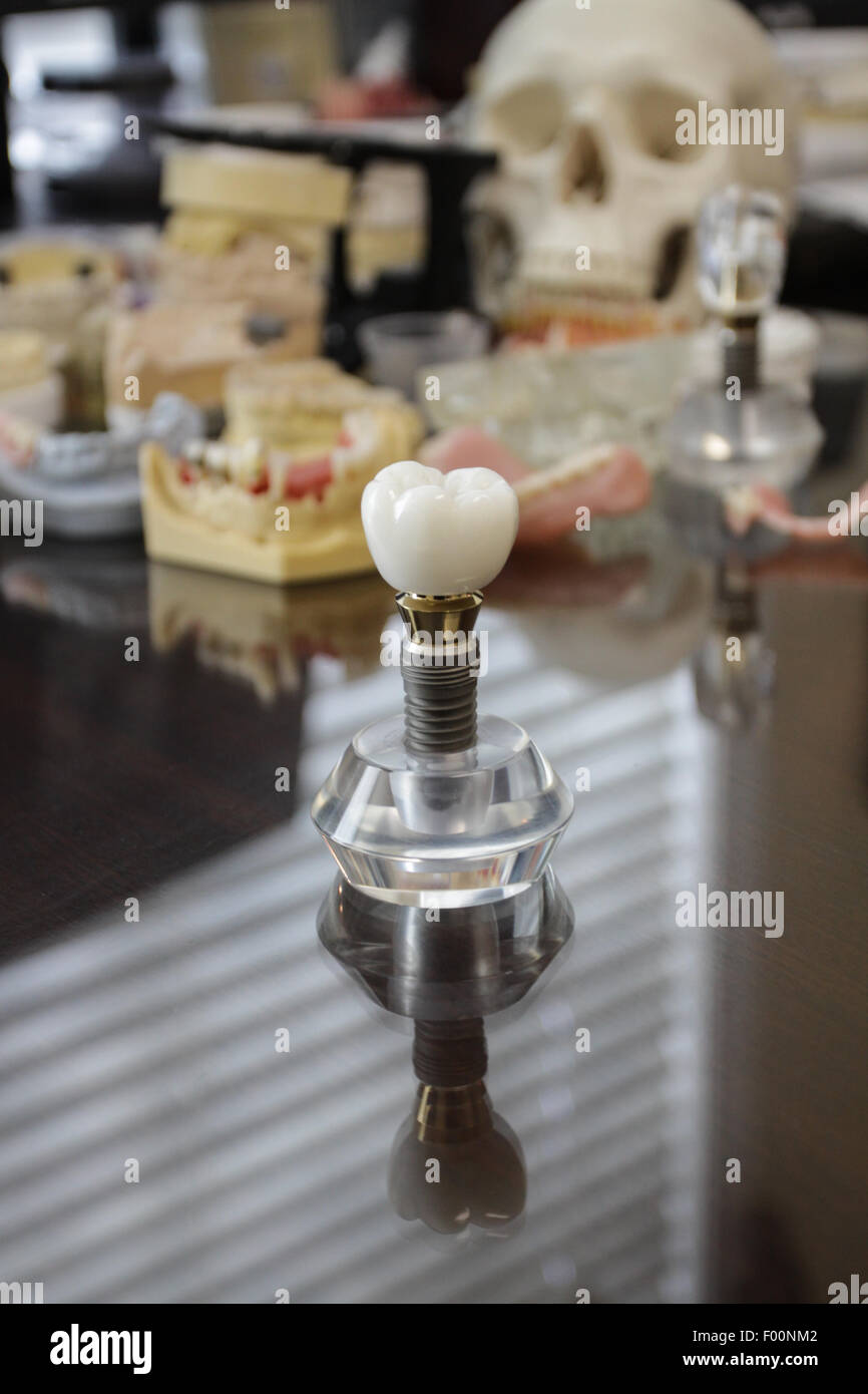 Giant tooth on crystal stand with reflection on desktop Stock Photo - Alamy