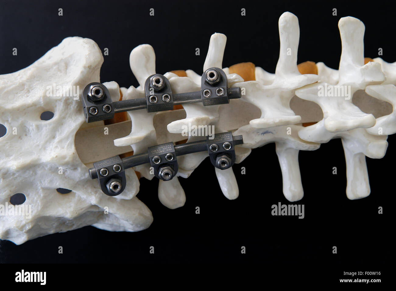 Orthopedic Institute Galeazzi (Milan, Italy), prosthesis for the ...
