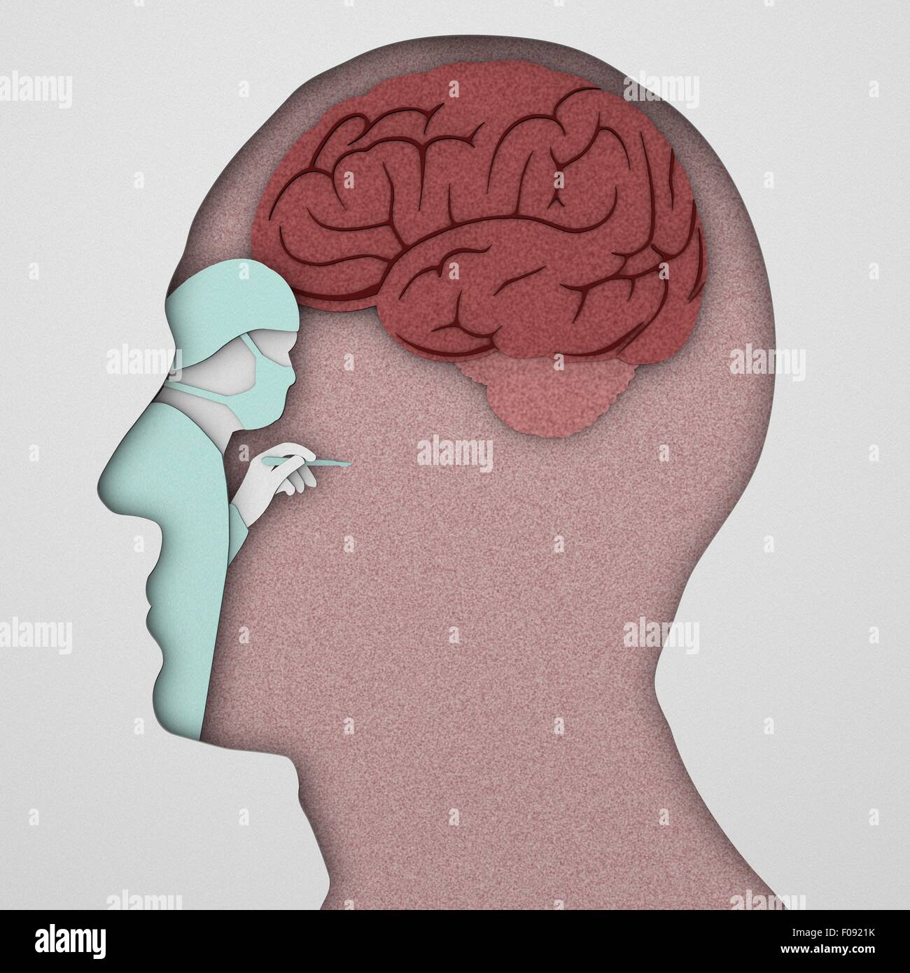 Illustration of brain surgeon doctor and patient brain Stock Photo - Alamy