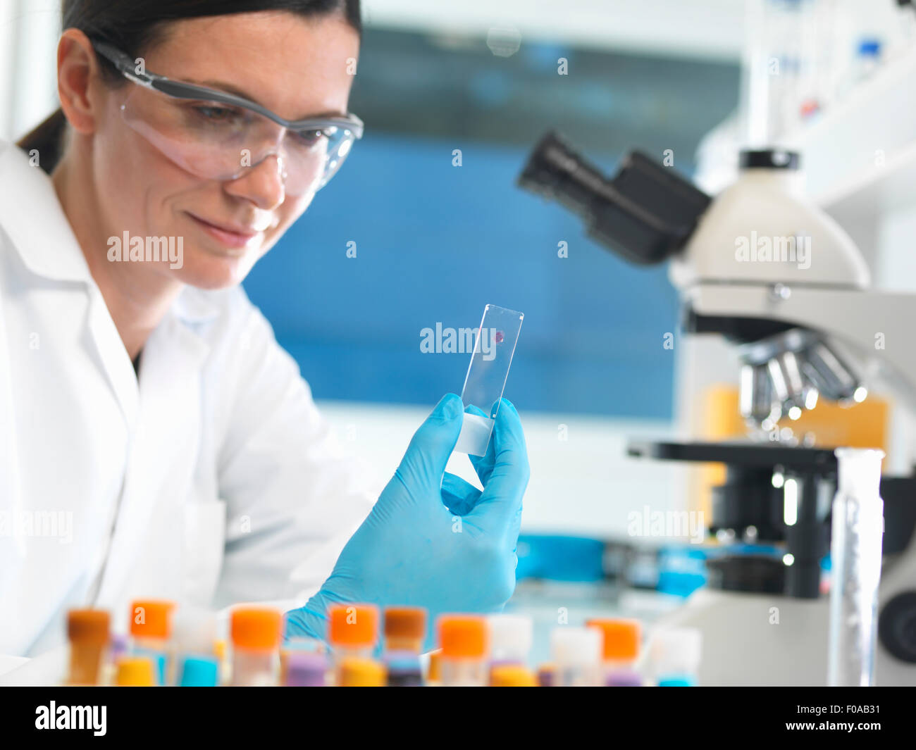 Microscope slide blood hi-res stock photography and images - Alamy