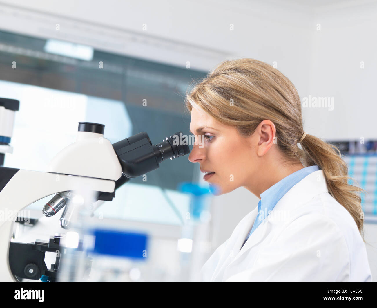 Blood sample on microscope slide hi-res stock photography and images ...