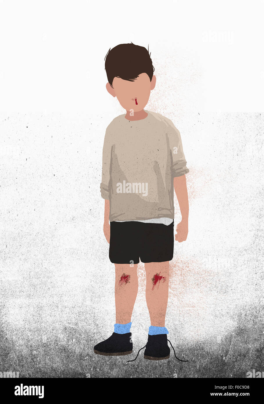 Illustrative image of boy with bleeding knees and nose over white ...