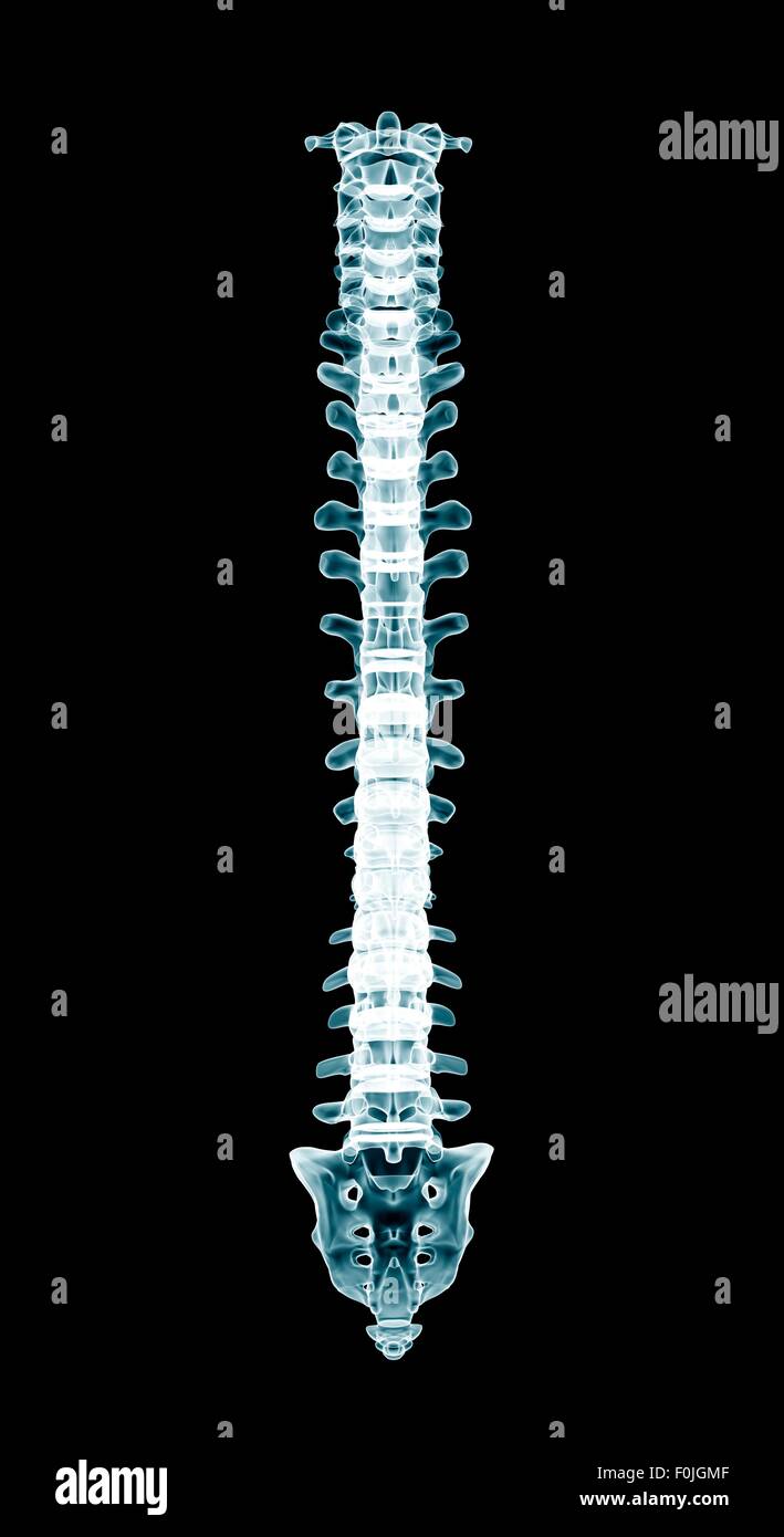 xray human spine isolated on a black background Stock Photo - Alamy