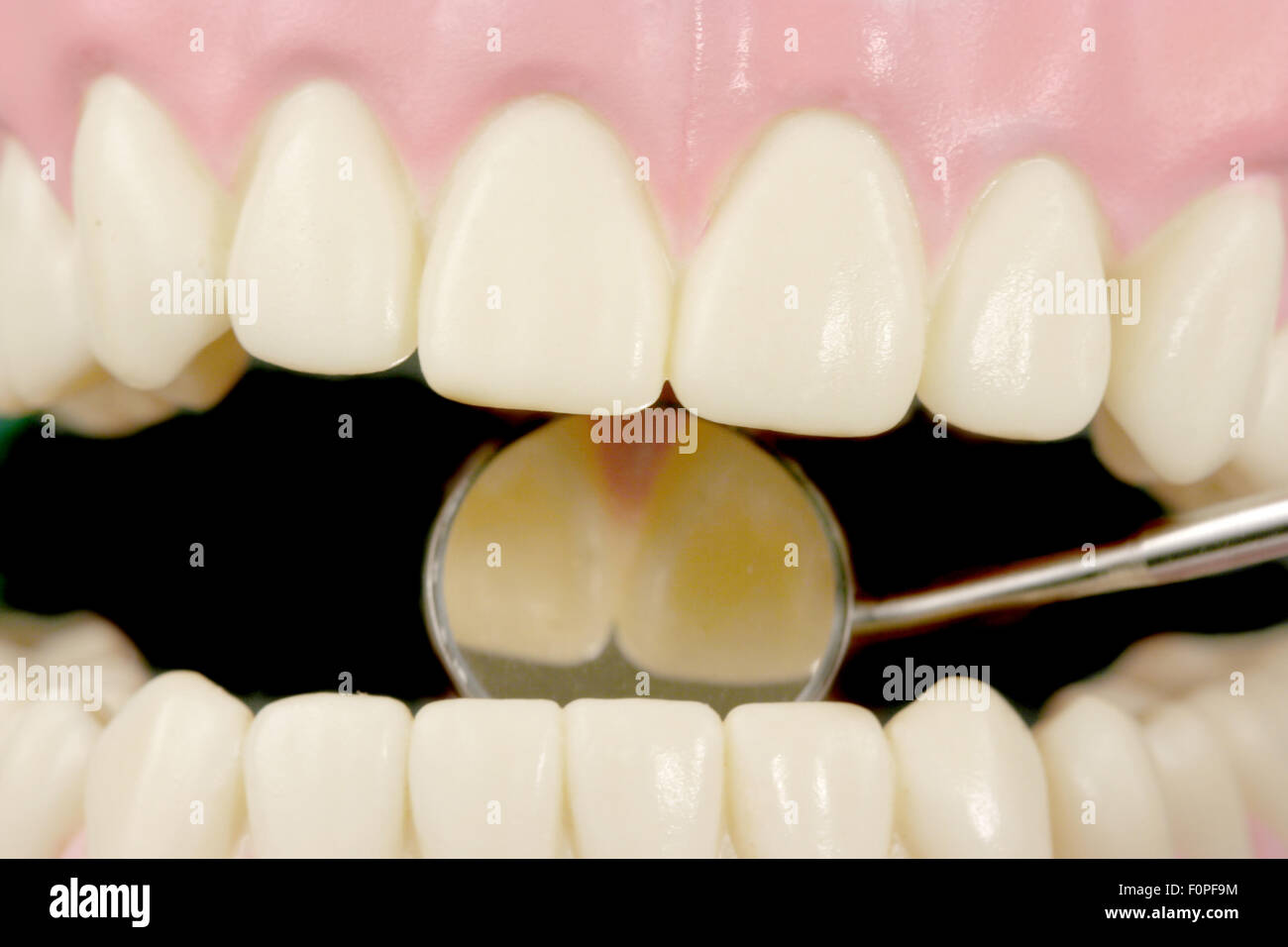 Teeth cavity open mouth hi-res stock photography and images - Alamy
