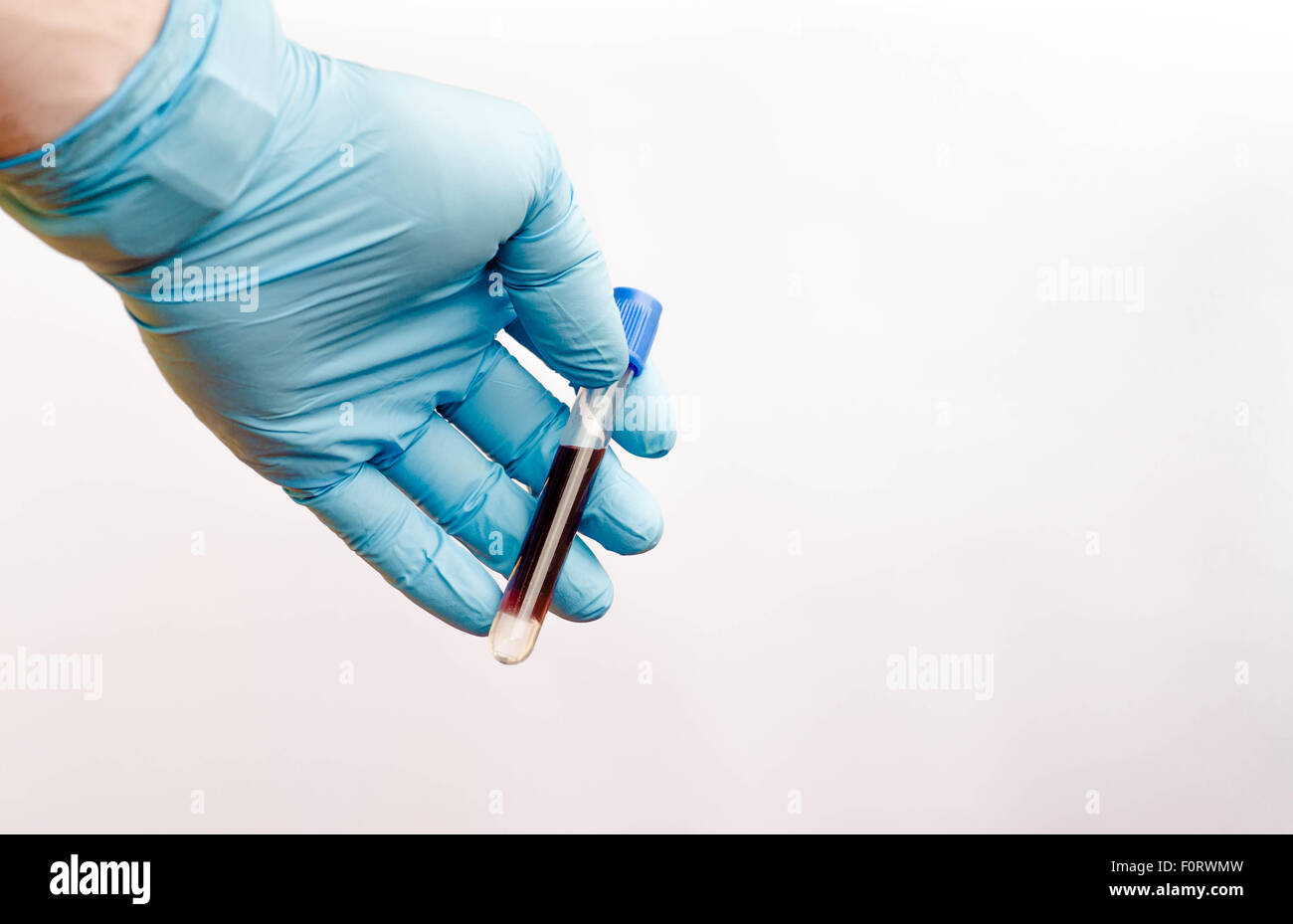 Sample sterile hi-res stock photography and images - Alamy