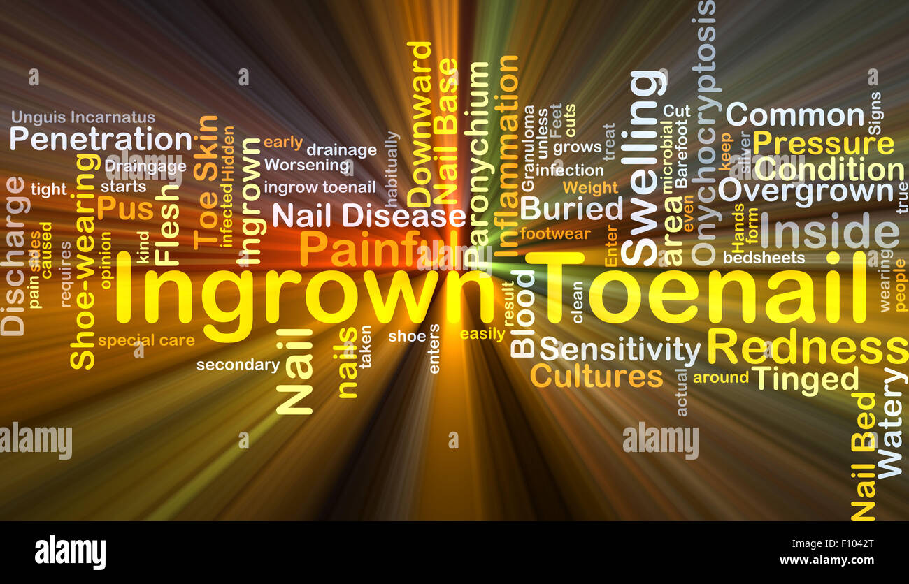 Background concept wordcloud illustration of ingrown toenail glowing ...