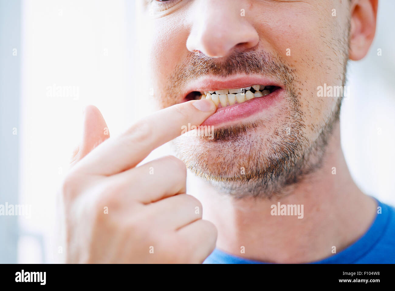 Close up toothache man tooth hi-res stock photography and images - Alamy