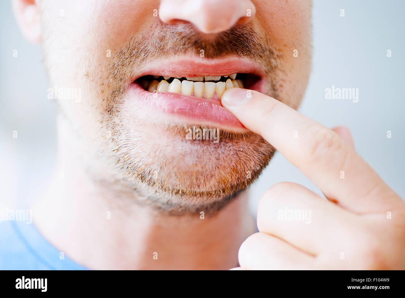 MAN WITH TOOTHACHE Stock Photo - Alamy