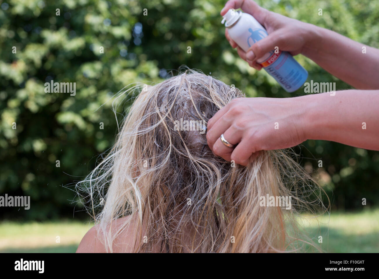 TREATMENT FOR SUCKING LICE - child little blond girl hair with lice ...
