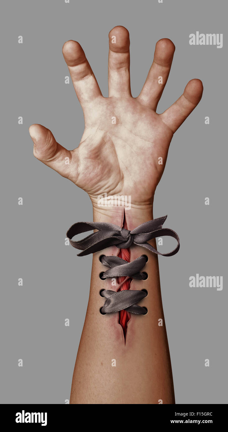 Razor Blade Cuts On Wrist