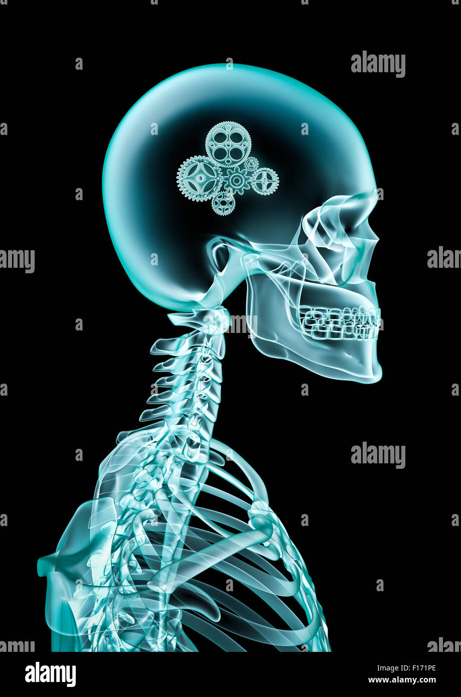 X-ray cogs / 3D render of x-ray showing cogwheels inside head Stock ...