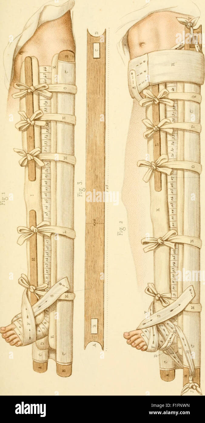 This 1859 manual provides comprehensive instructions on surgical ...