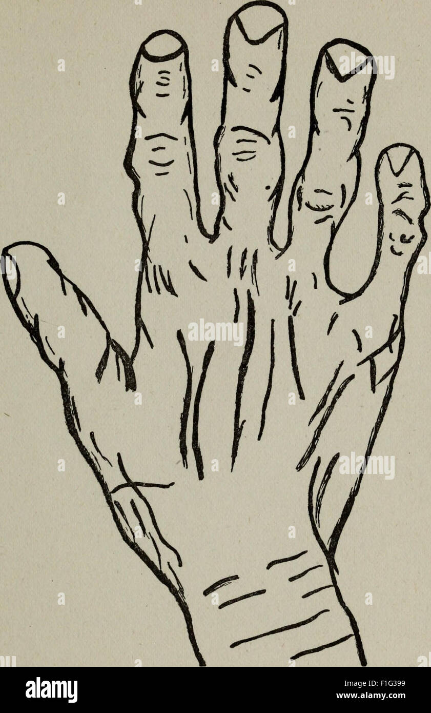 'Perin's Science of Palmistry' from 1902 is a comprehensive guide to ...