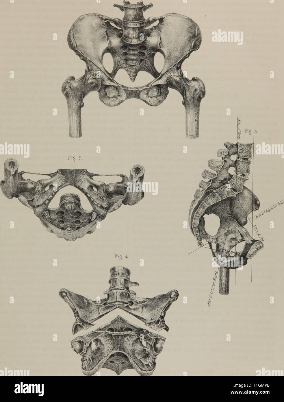 The principles and practice of obstetrics (1864 Stock Photo - Alamy