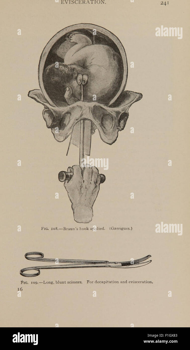 This 1915 handbook offers detailed guidance on obstetric care ...