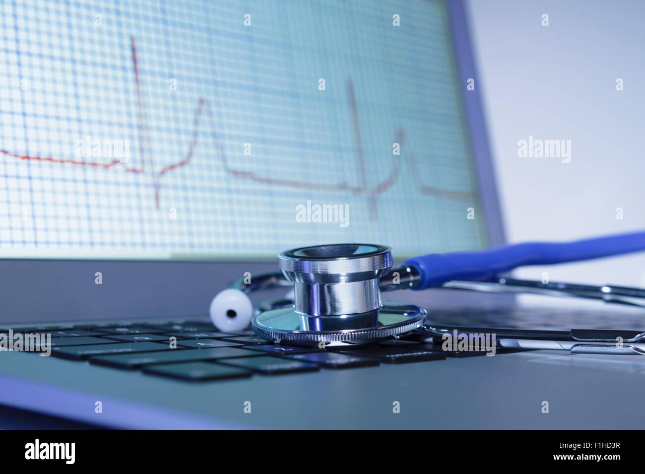 Modern cardiology. Acoustic stethoscope on a laptop computer displaying ...