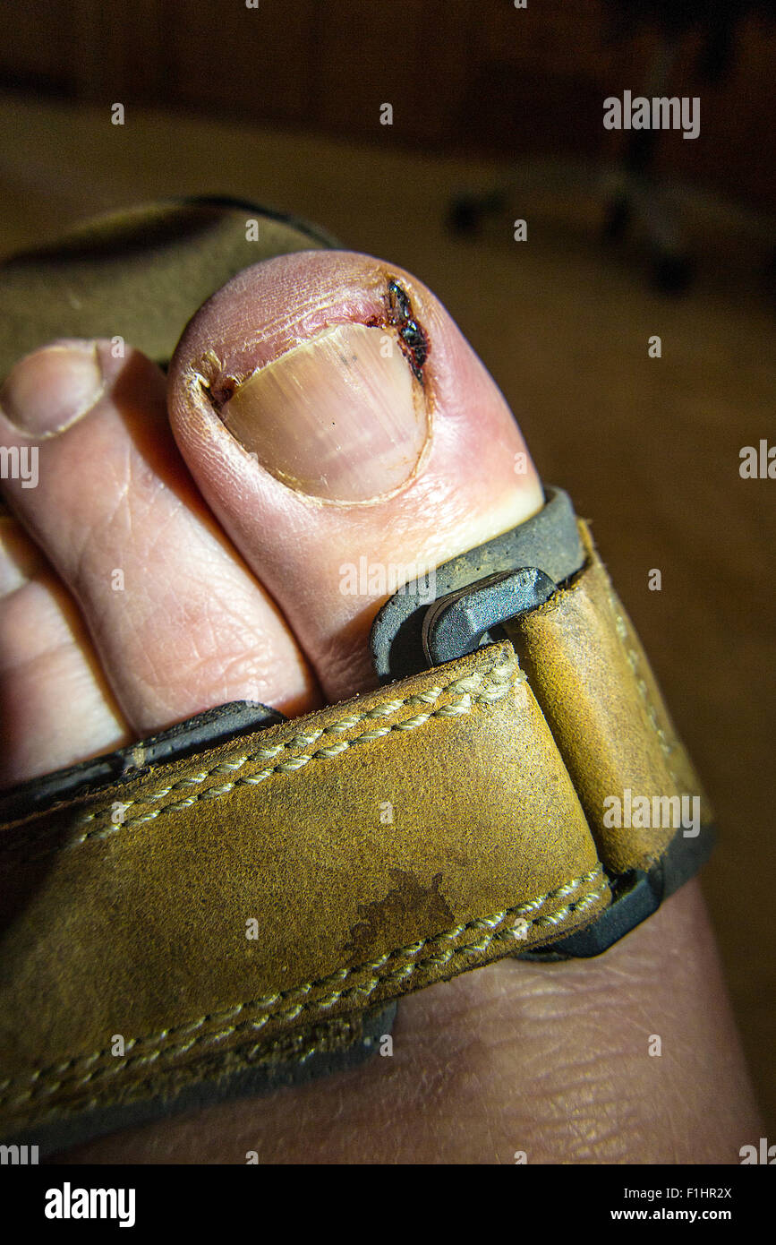 Hyponychium hi-res stock photography and images - Alamy