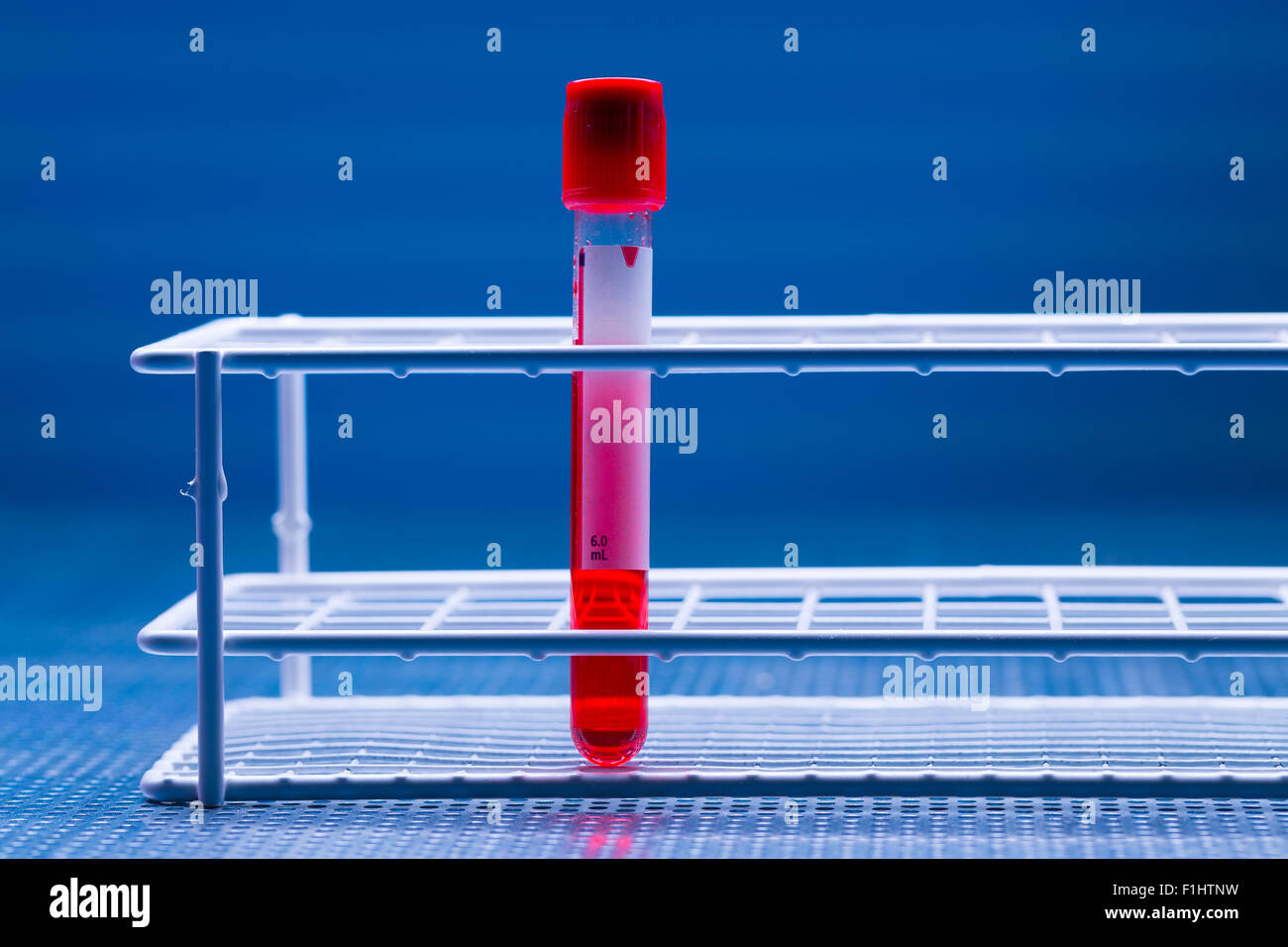 Blood test hi-res stock photography and images - Alamy