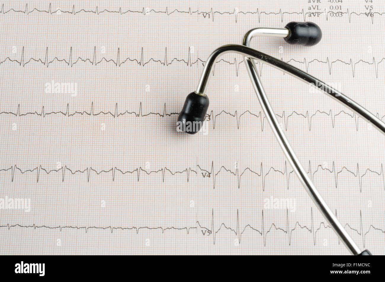 Electrocardiogram hi-res stock photography and images - Alamy