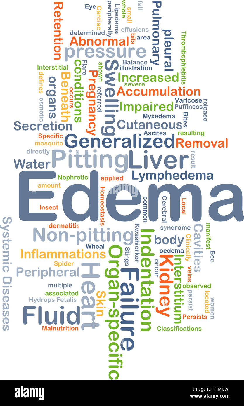 Edema hi-res stock photography and images - Alamy