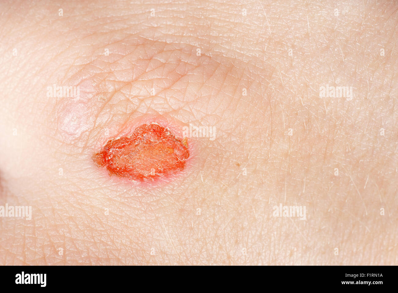 Hand cut blood bleeding hi-res stock photography and images - Alamy
