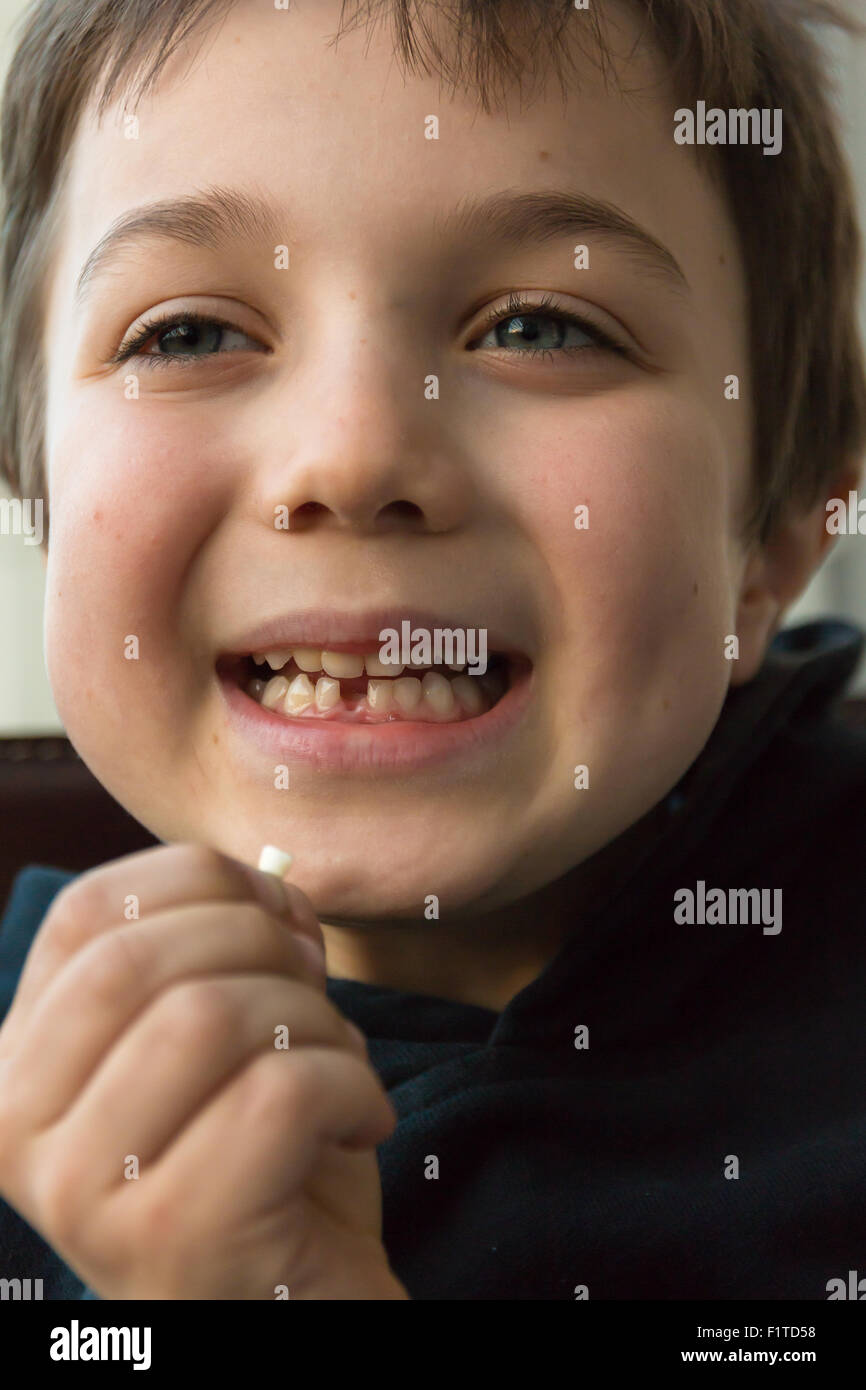 Boy missing front teeth hi-res stock photography and images - Alamy