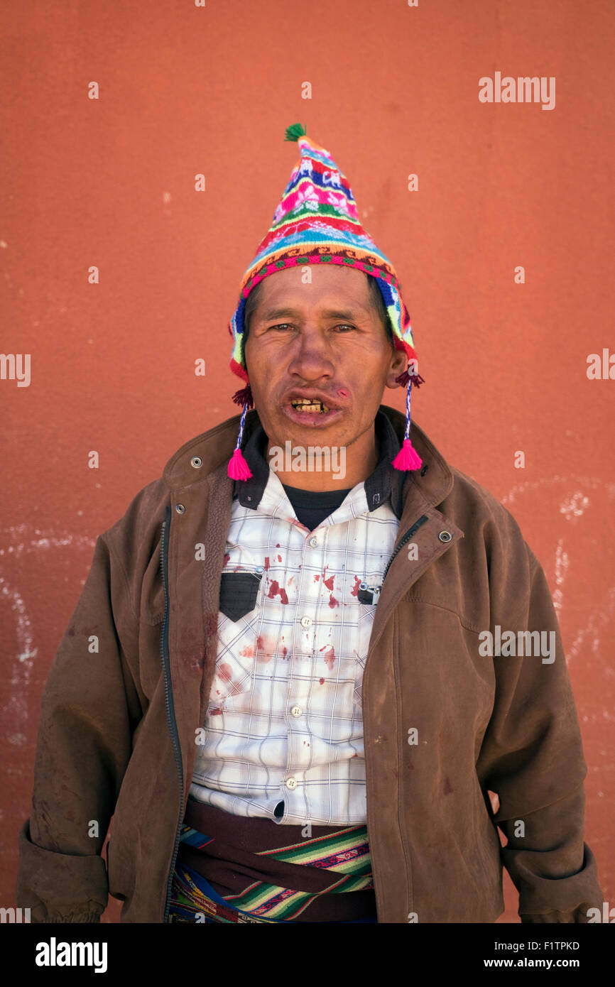 A man has several wounds on his face after being involved in a fight ...