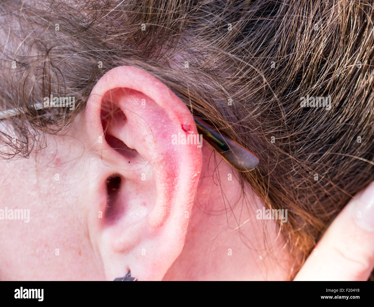 Ear Shape High Resolution Stock Photography and Images - Alamy