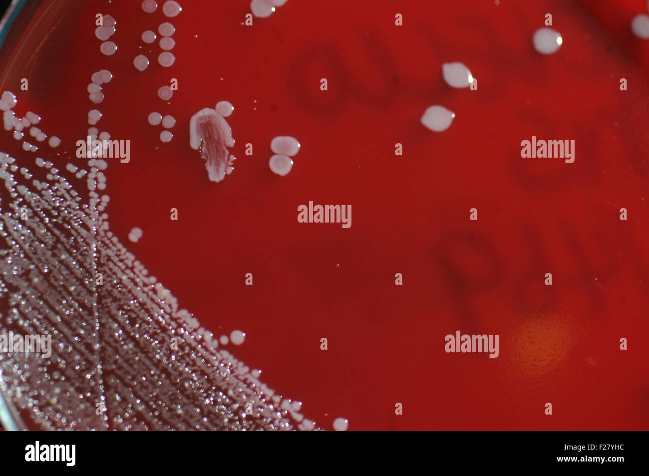 Bacterial colonies growing on culture of sheep's blood Stock Photo - Alamy