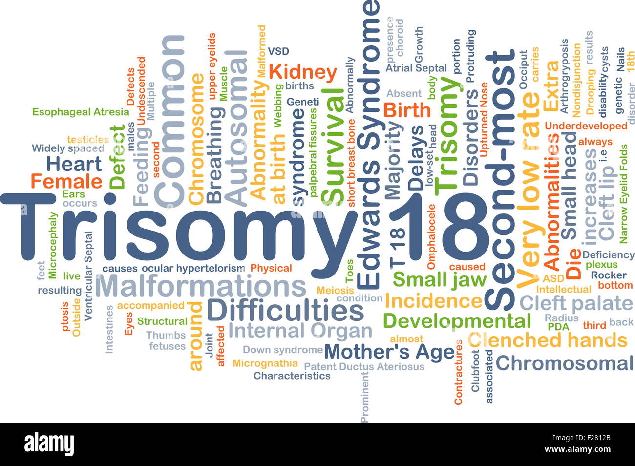 Trisomy 18 hi-res stock photography and images - Alamy