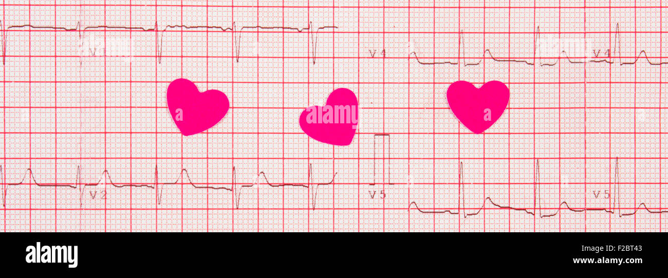 Hearts of paper lying on electrocardiogram graph, ecg heart rhythm ...