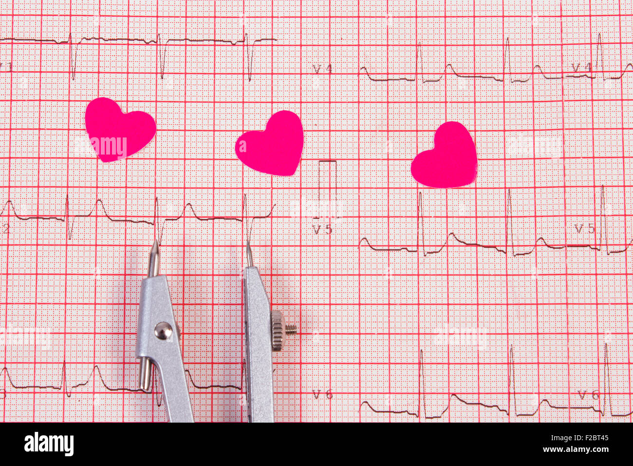 Hearts of paper and calipers lying on electrocardiogram graph, ecg ...