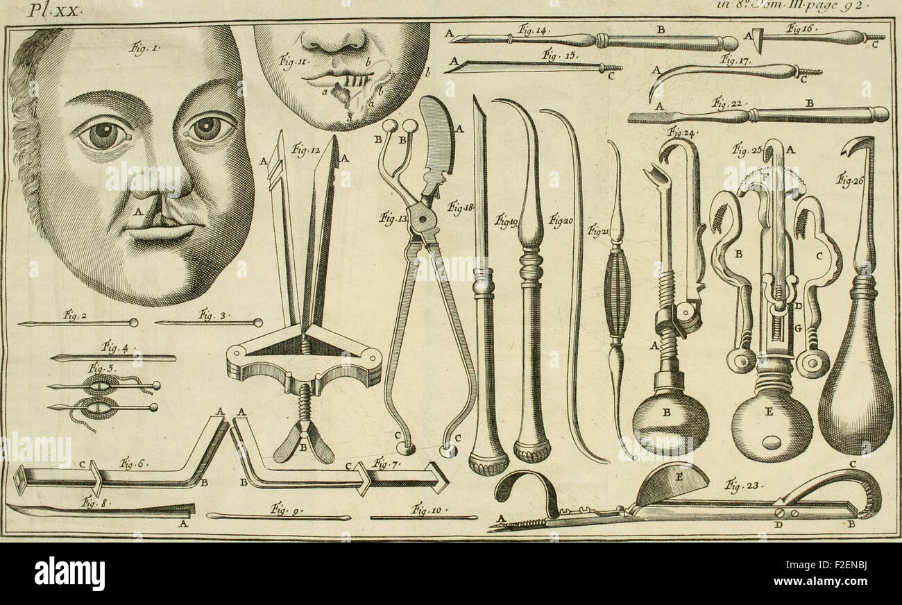 This historical work on surgery presents a clear and new approach to ...