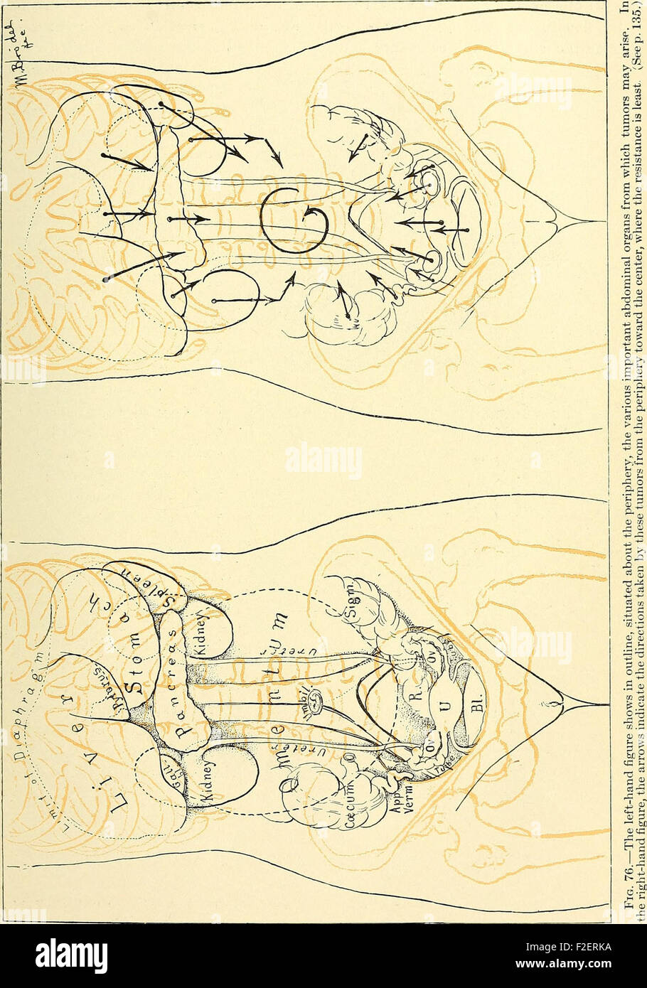 *Operative Gynecology* (1906) is a medical textbook that discusses ...