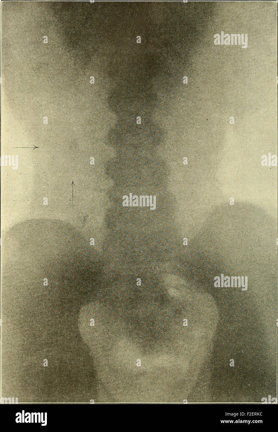 This 1906 text on operative gynecology provides a detailed examination ...