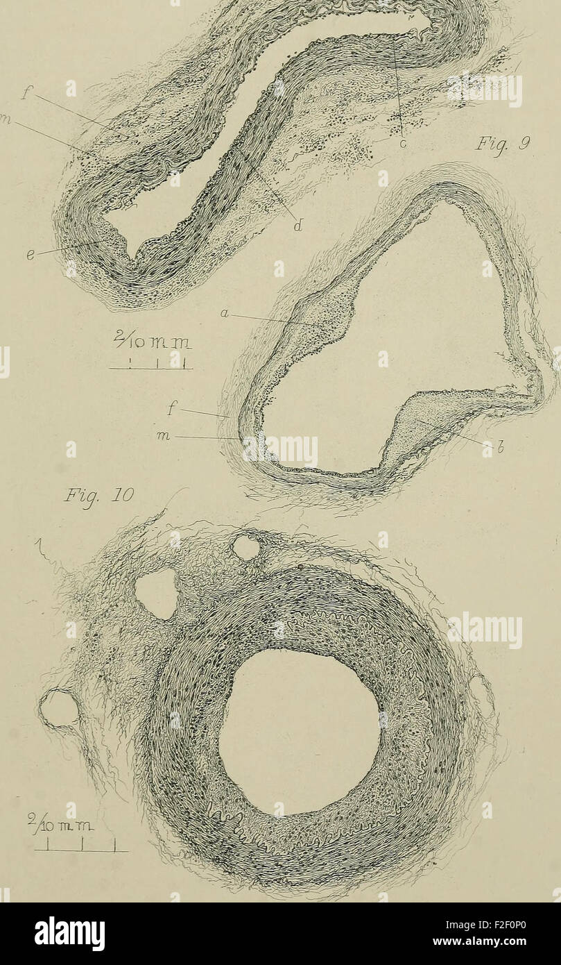 *The Origin of Disease* (1900) examines the causes of disease, focusing ...
