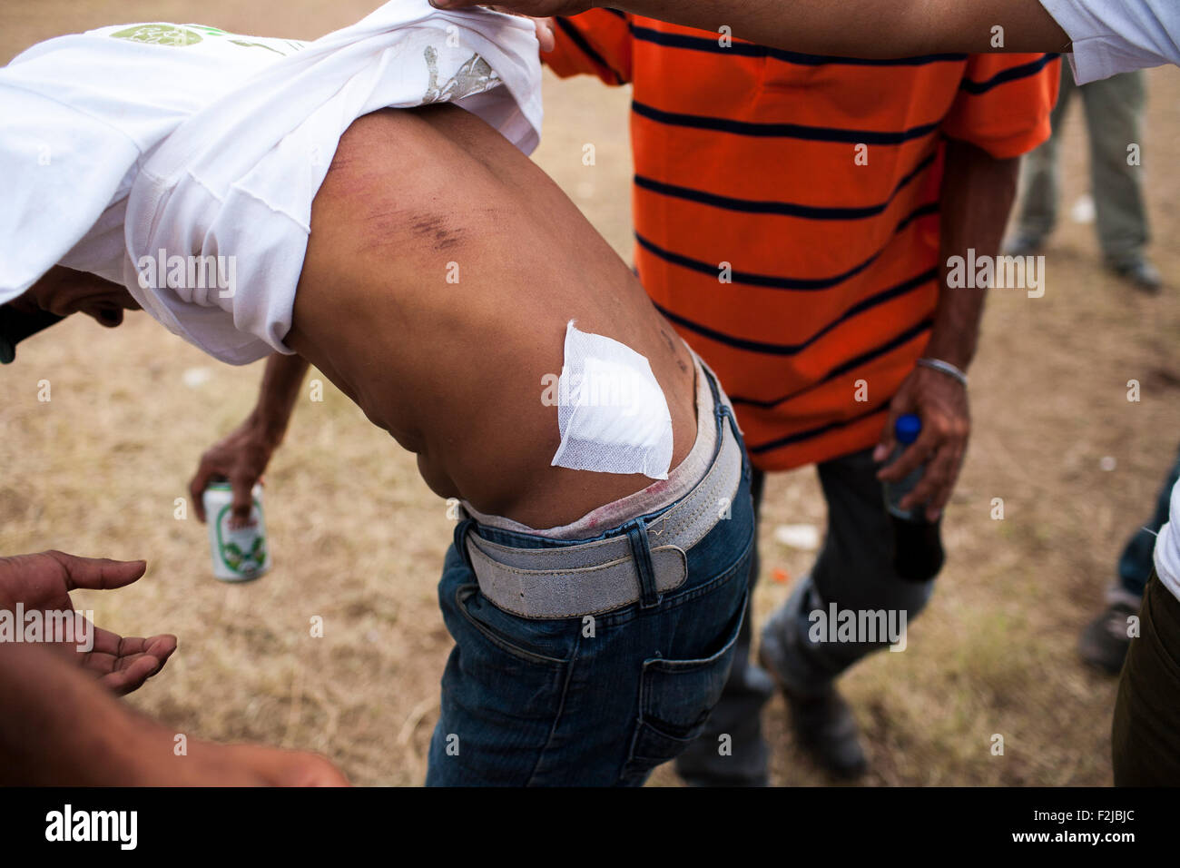A rider shows his injuries from a bull during the annual fiesta in ...